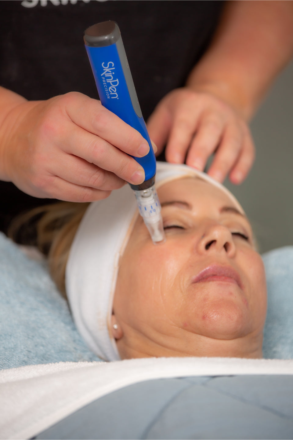 Skinpen Microneedling – The Beauty Parlour